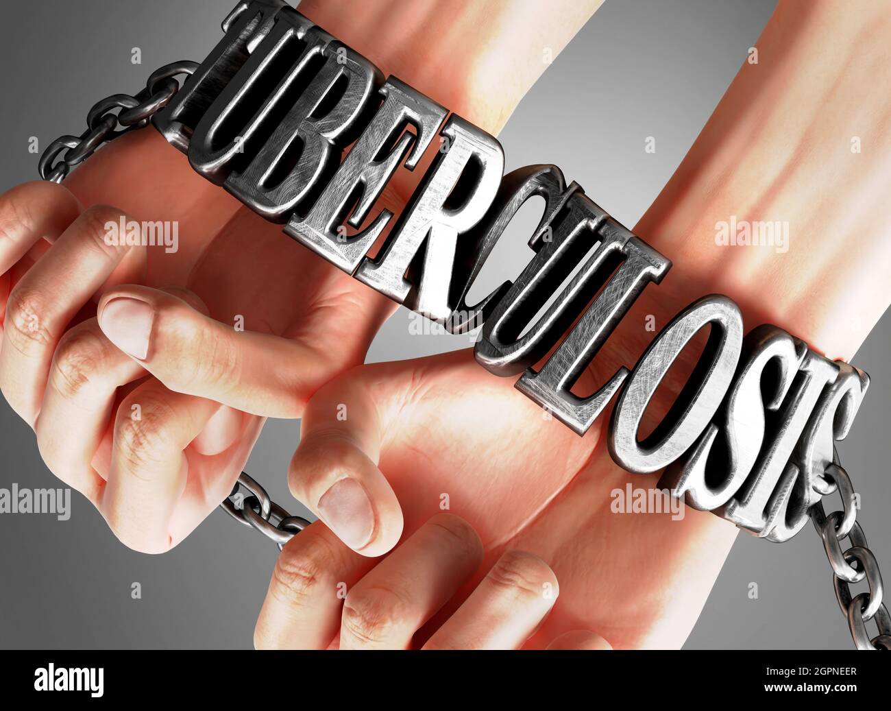 Tuberculosis, social impact and its influence - a concept showing a ...