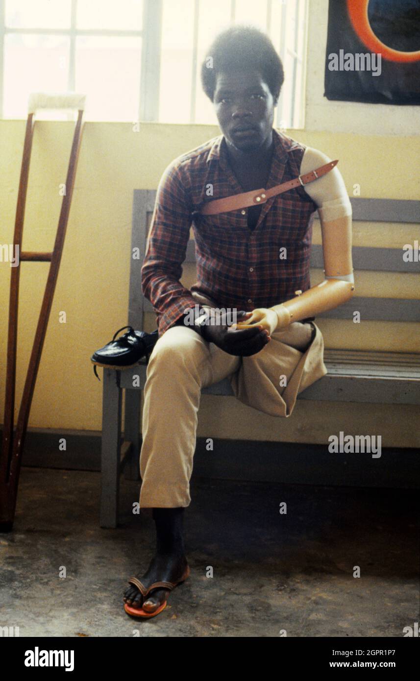 Land Mine victims after losing limbs from exploding land mines. Uganda ...