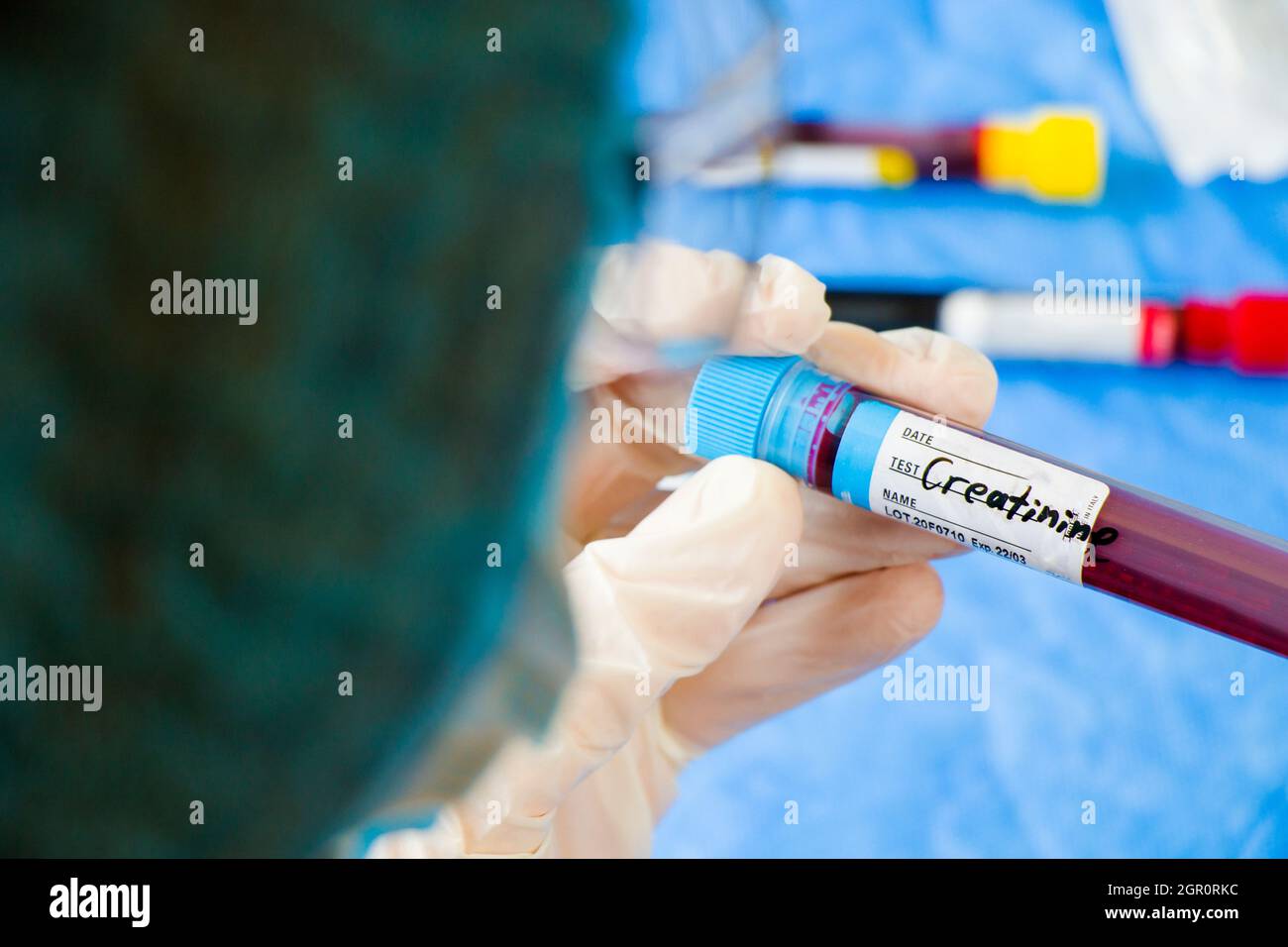 Kidney health test hi-res stock photography and images - Alamy