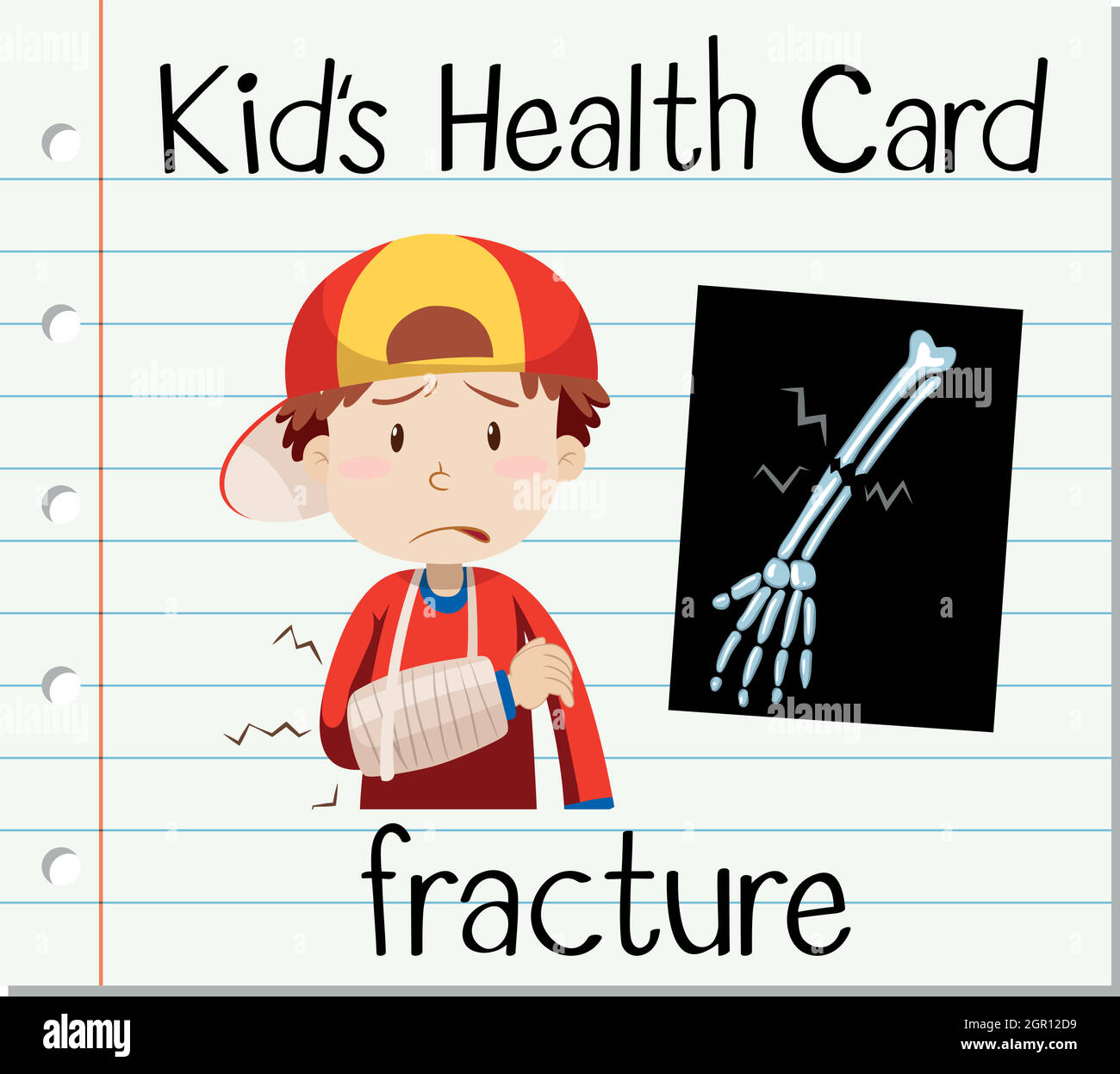 Fracture Stock Vector Images - Alamy