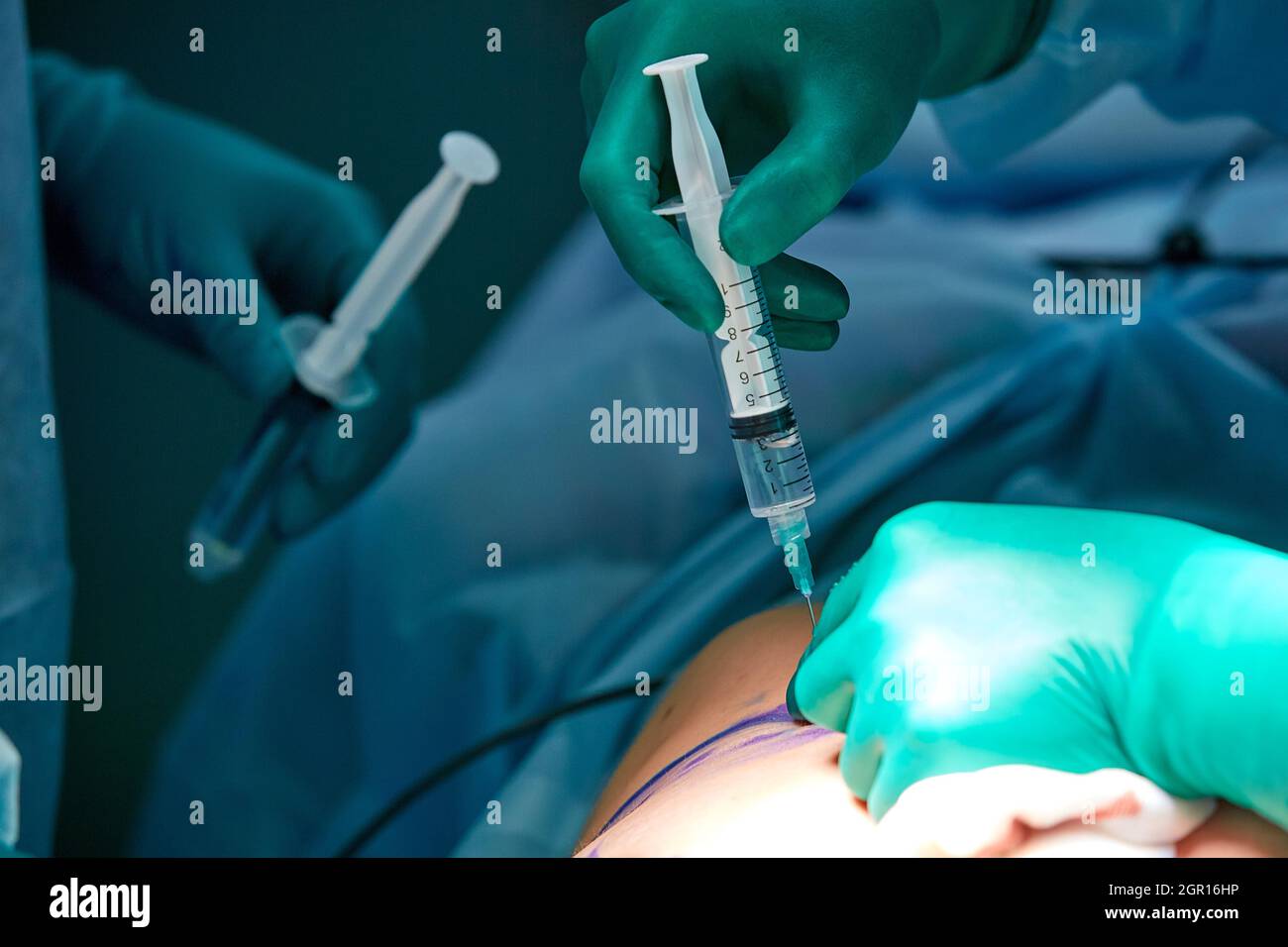 Close up picture of doctor 's hand while inject the anesthetic agent ...