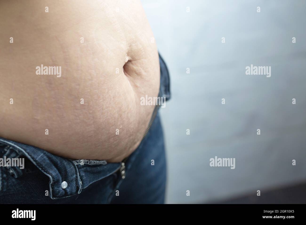Woman obese pregnant hi-res stock photography and images - Alamy