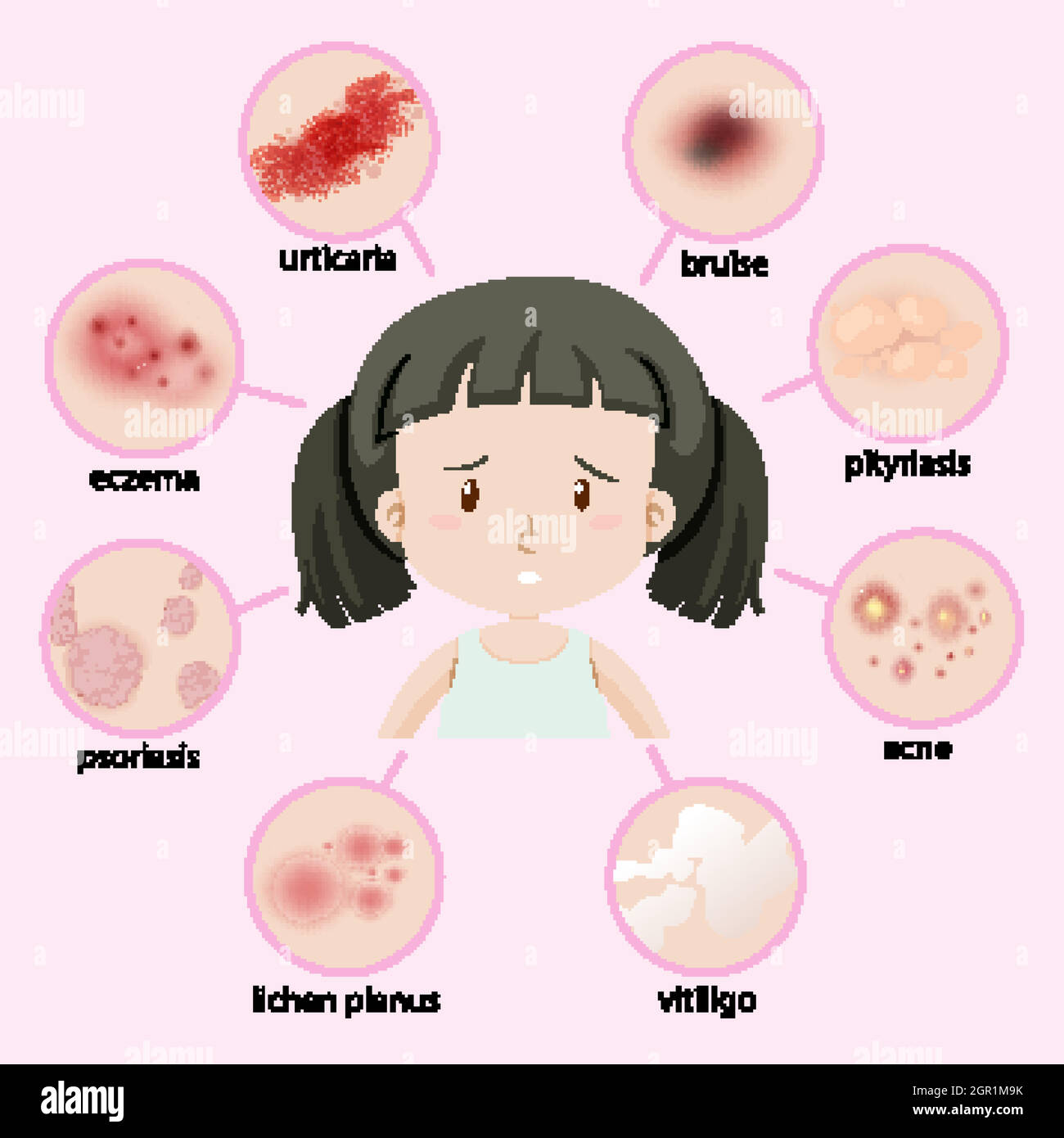 Diagram showing different types of disease in kid Stock Vector Image ...