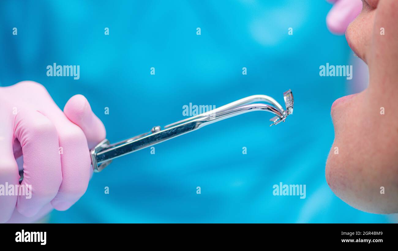 Root Canal Treatment High Resolution Stock Photography and Images - Alamy