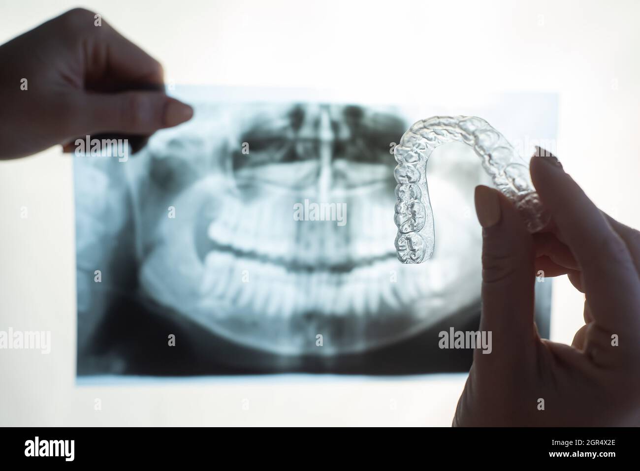 Hand x ray ring hi-res stock photography and images - Alamy