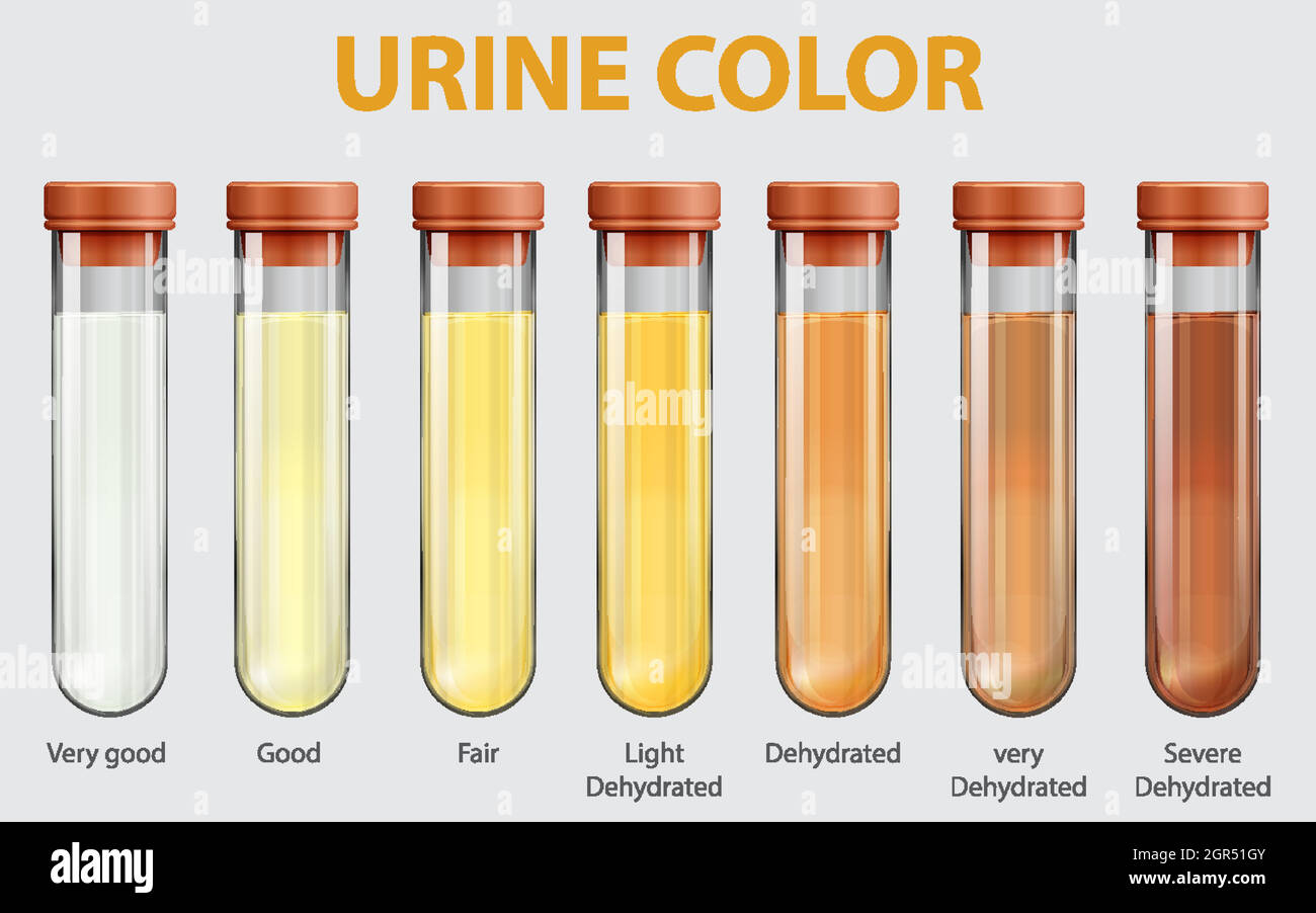 Illustration of urine color chart Stock Vector Image & Art - Alamy