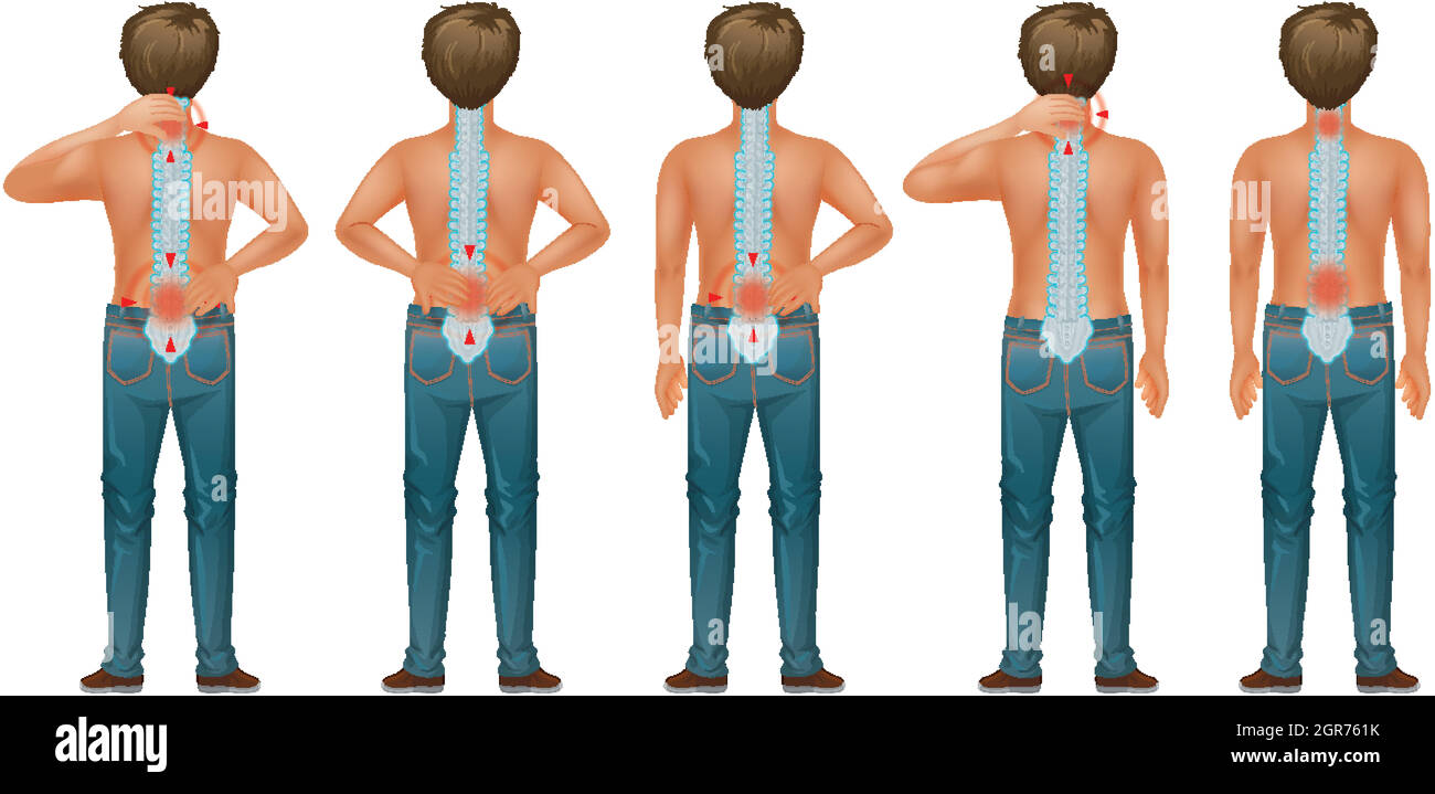 Diagram showing human man with back pain Stock Vector Image & Art - Alamy