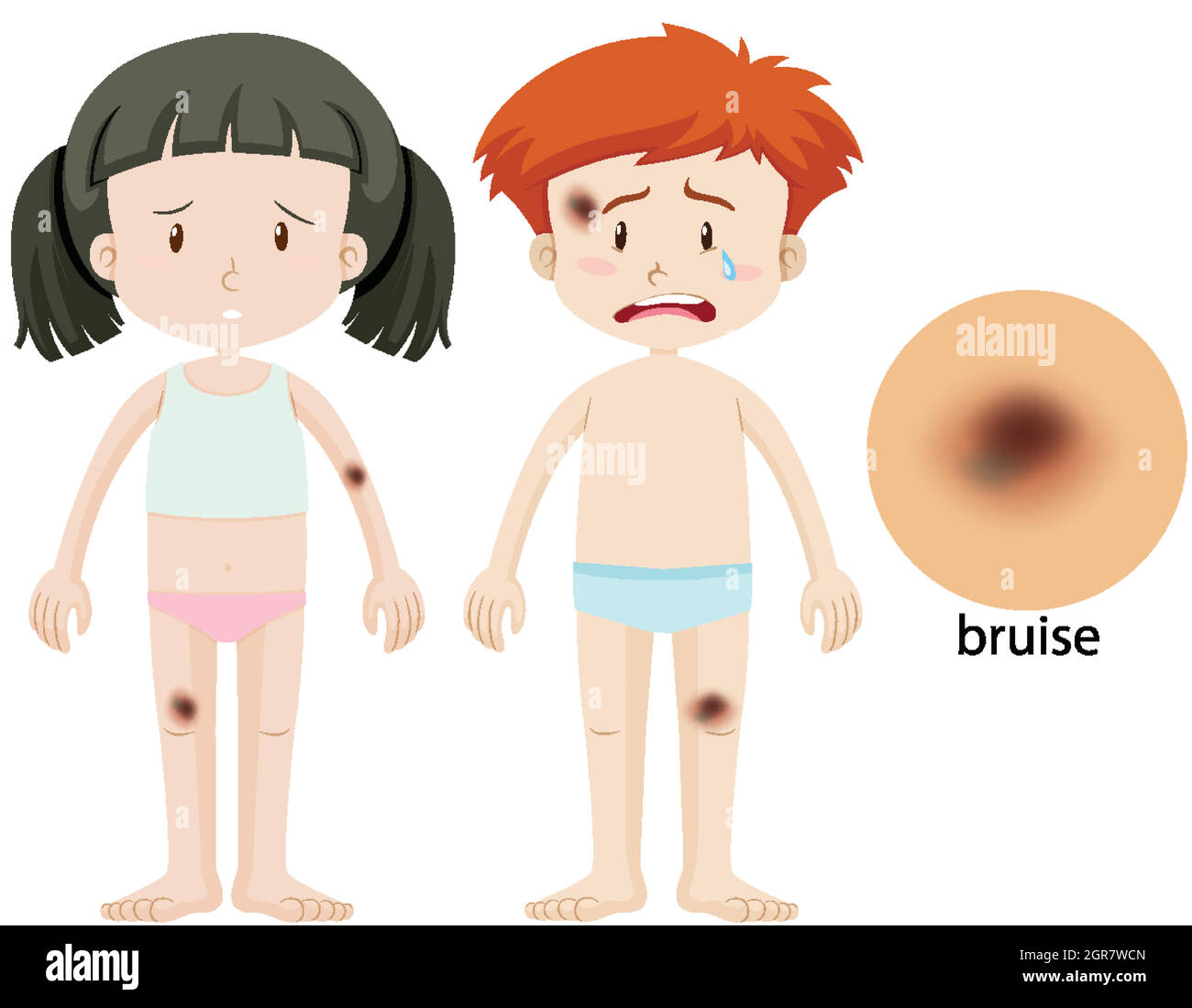 Boy and girl with bruise Stock Vector Image & Art - Alamy