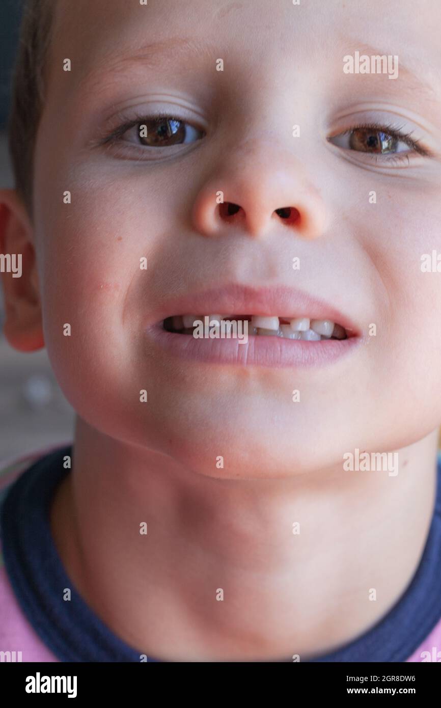 Tooth pushing hi-res stock photography and images - Alamy