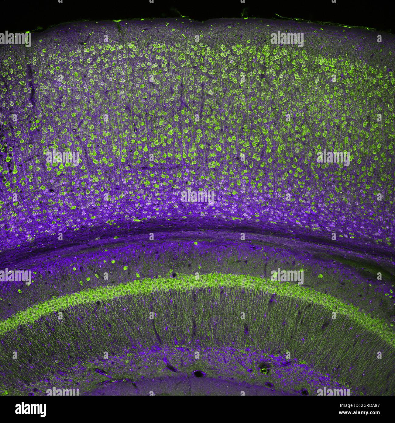 Cerebral cortex and part of the hippocampus under it in a section of a ...
