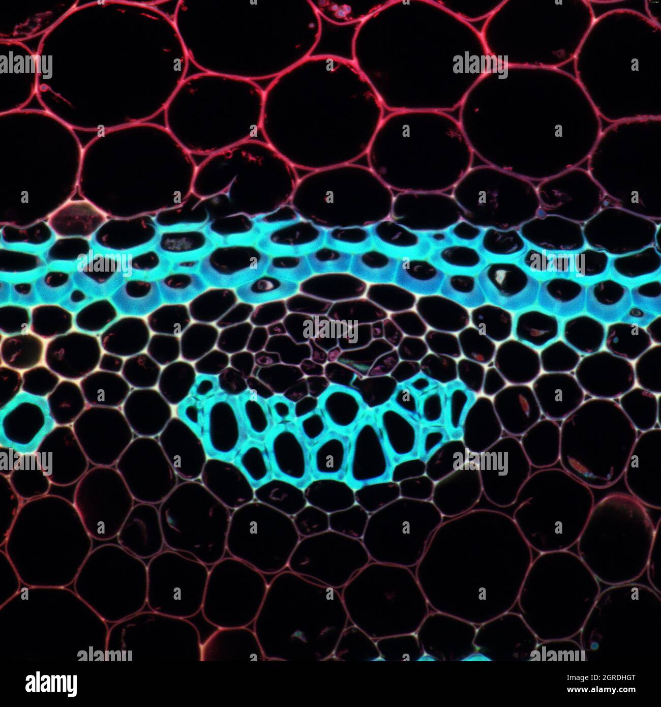 Convallaria plant microscopic sample, fluorescence signal observed with ...