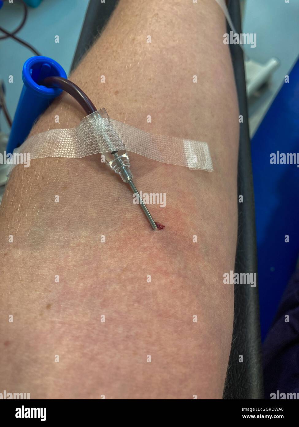 A blood donor gives blood in an NHS blood donation centre with needle ...