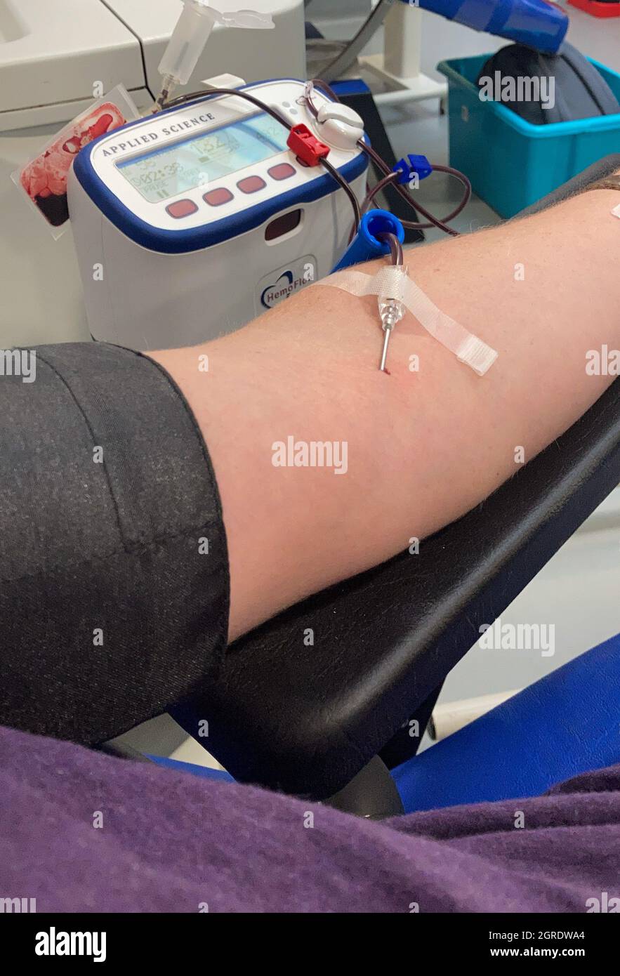 A blood donor gives blood in an NHS blood donation centre with needle ...