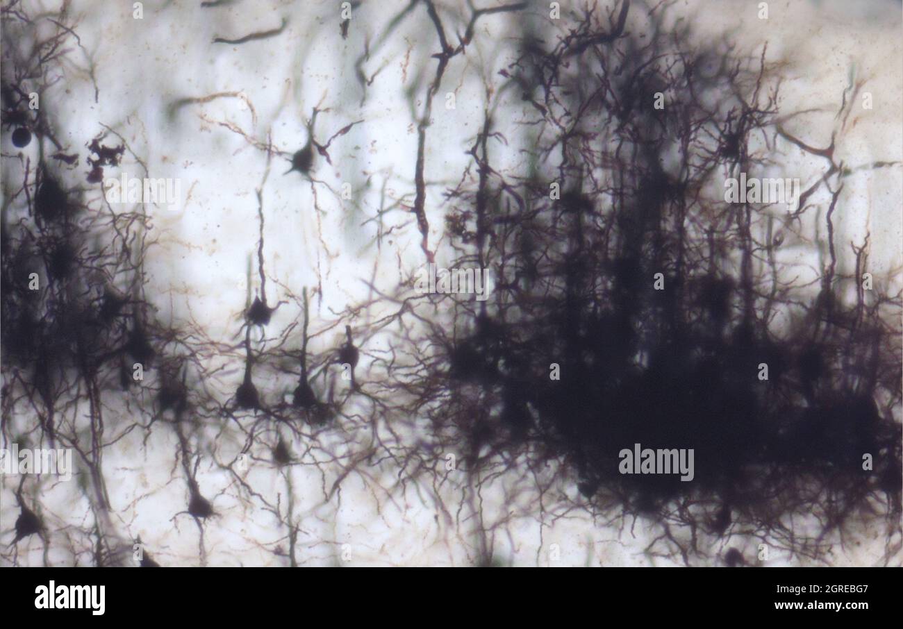 Mouse brain cells hi-res stock photography and images - Alamy