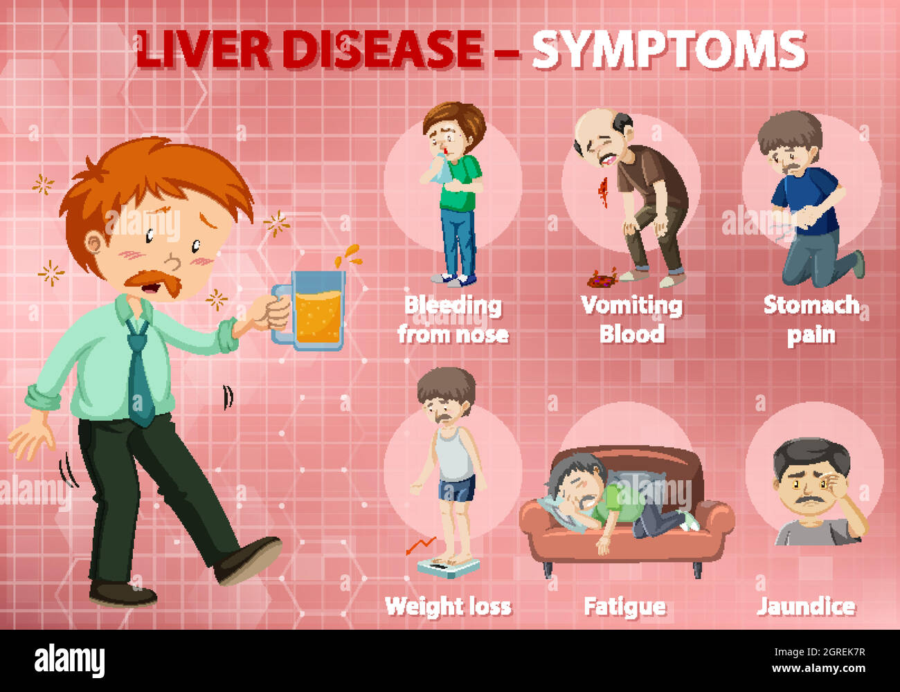 Liver disease symptoms cartoon style cartoon style infographic Stock ...