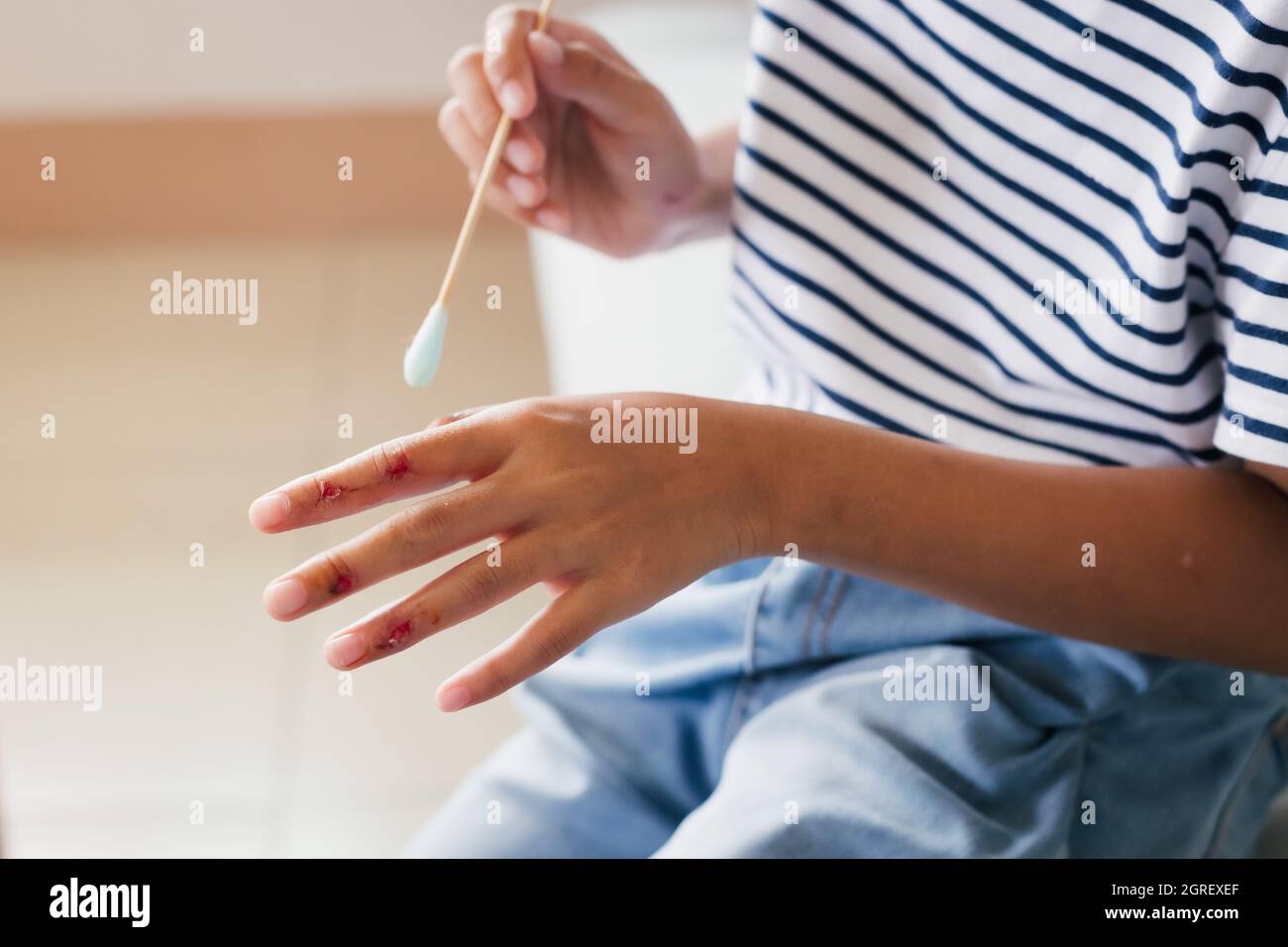 Blood wound finger nail hi-res stock photography and images - Alamy