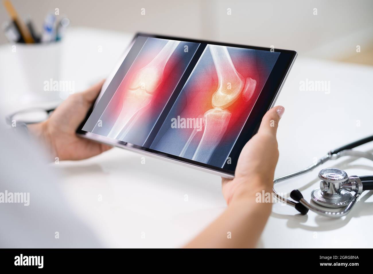 Doctor xray hi-res stock photography and images - Alamy