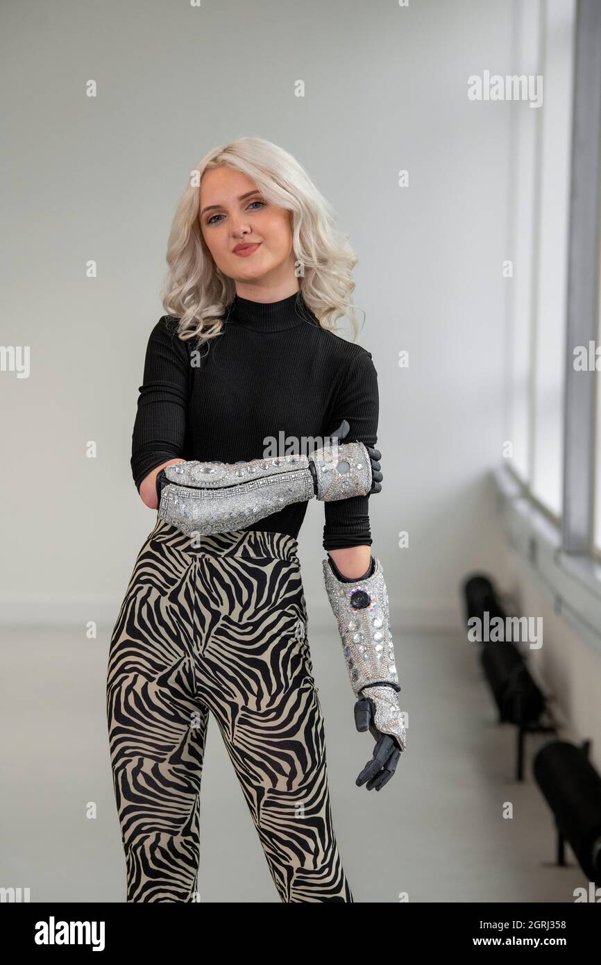 Tilly Lockey is a British amputee known for her bionic arms developed ...