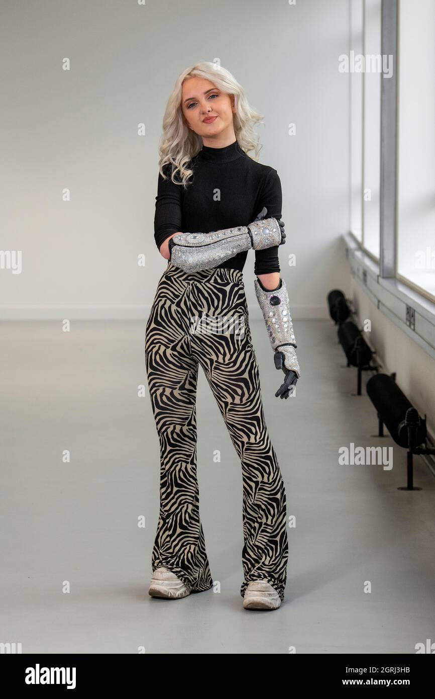 Tilly Lockey is a British amputee known for her bionic arms developed ...