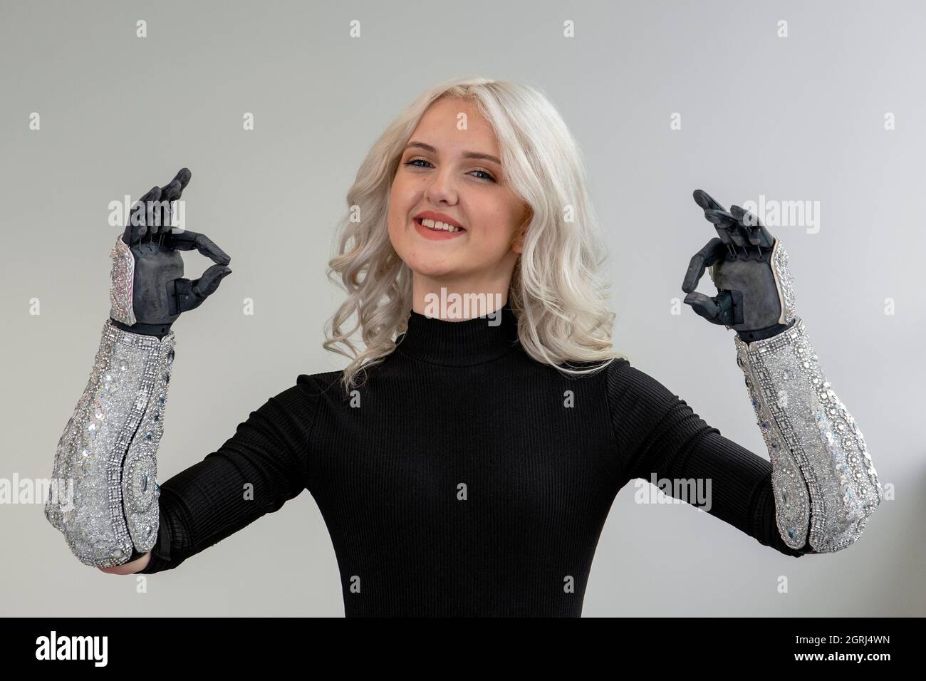 Tilly Lockey is a British amputee known for her bionic arms developed ...