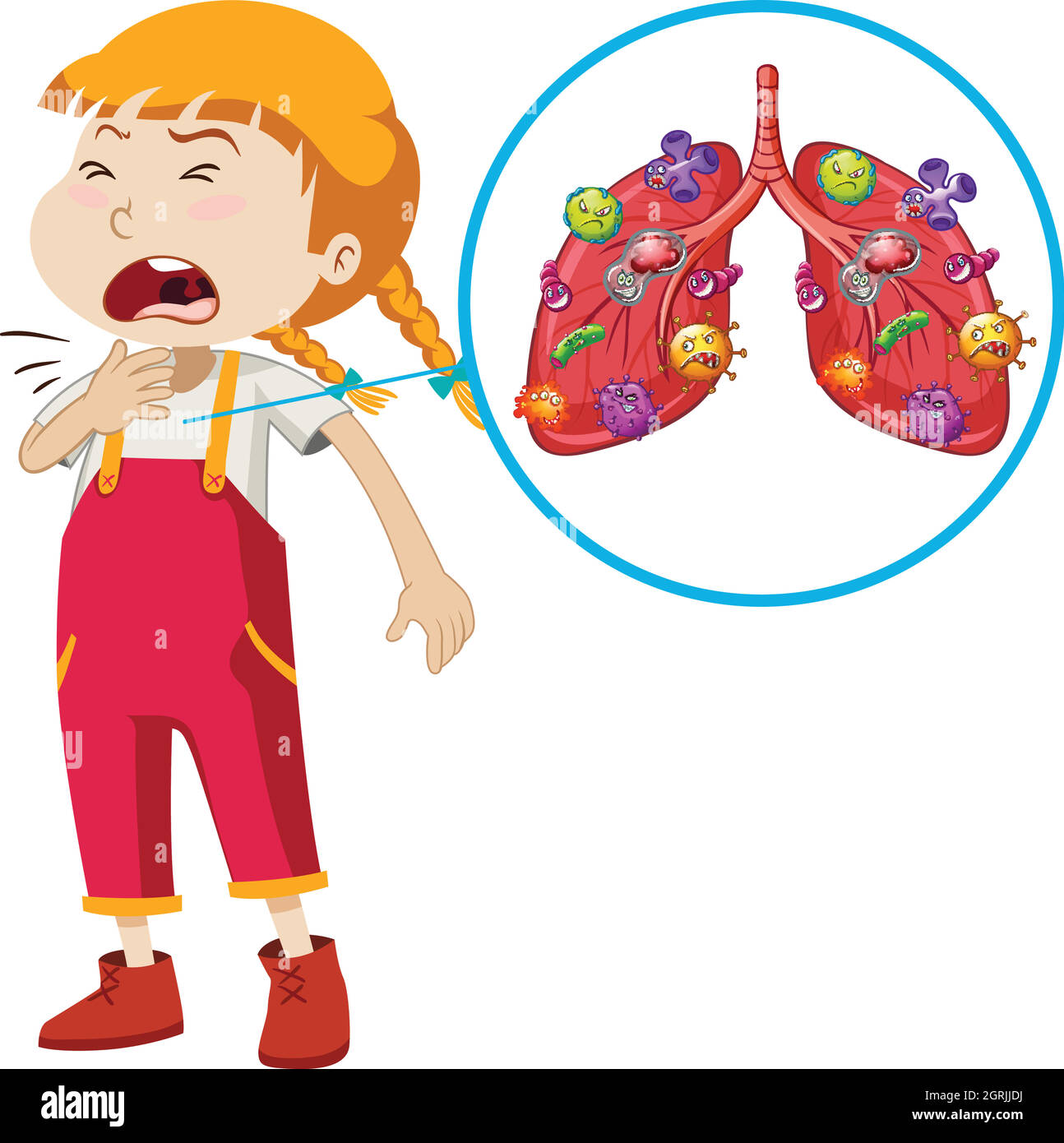 A Vector of Girl Lung Infection Stock Vector Image & Art - Alamy