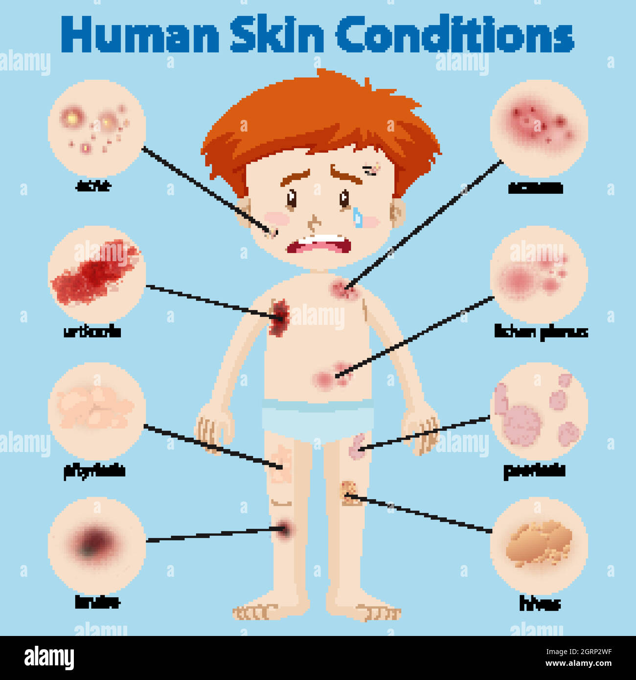 Diagram showing different skin conditions Stock Vector Image & Art - Alamy Diagram showing different skin conditions Stock Vector Image & Art - Alamy
