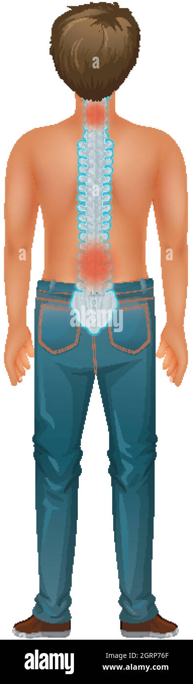Back of male human with back pain Stock Vector Image & Art - Alamy