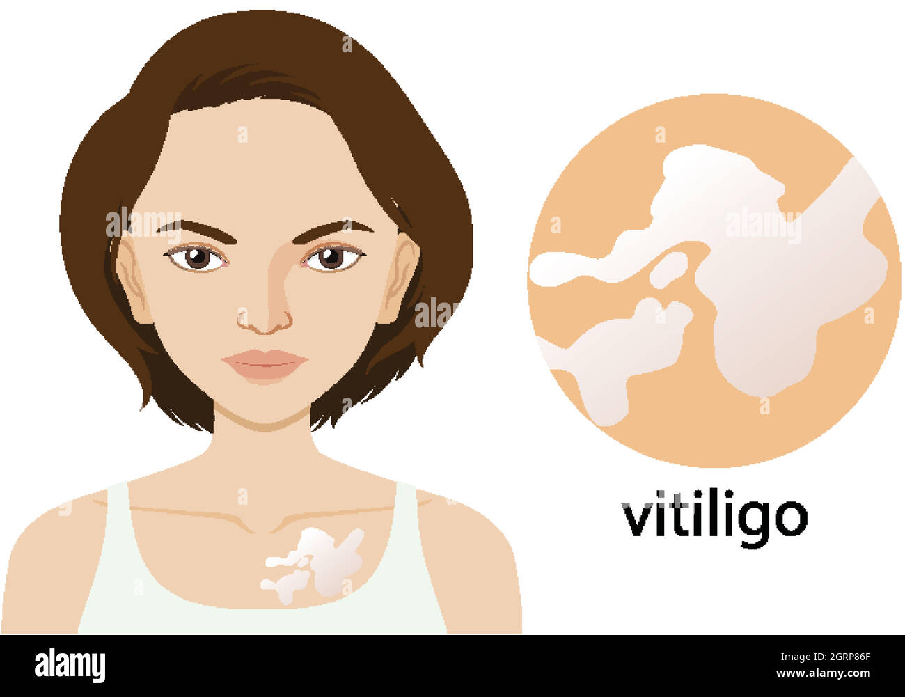 Anatomical drawing woman hi-res stock photography and images - Alamy