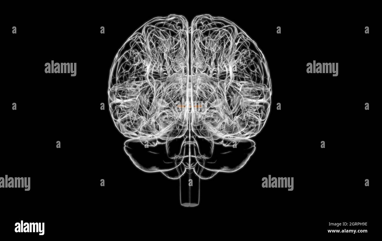 Brain Anterior commissure Anatomy For Medical Concept 3D Illustration ...