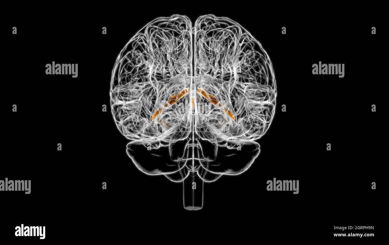 Brain Choroid plexus of cerebral hemisphere Anatomy For Medical Concept ...