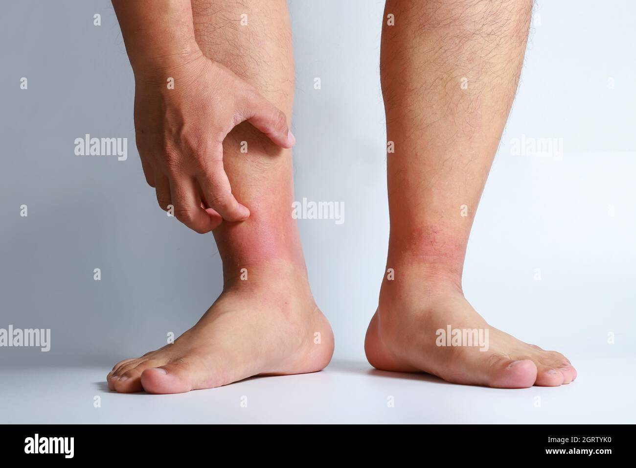 Man scratching leg hi-res stock photography and images - Alamy