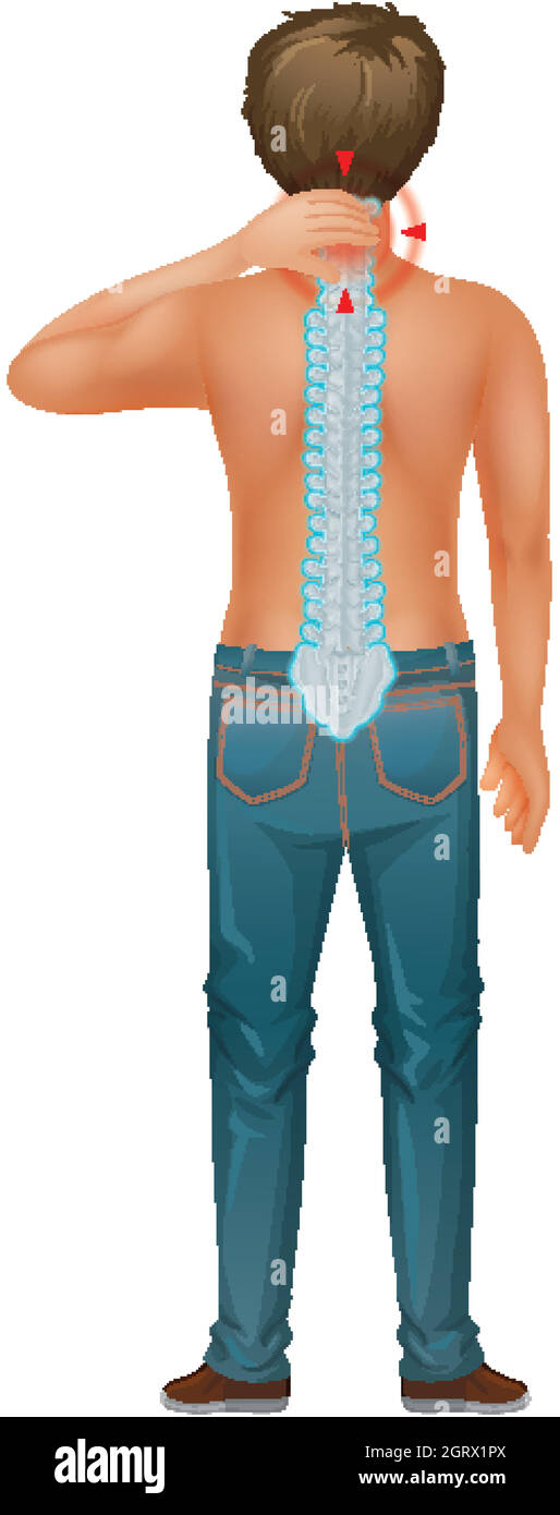 Back of man with spinal core injury Stock Vector Image & Art - Alamy