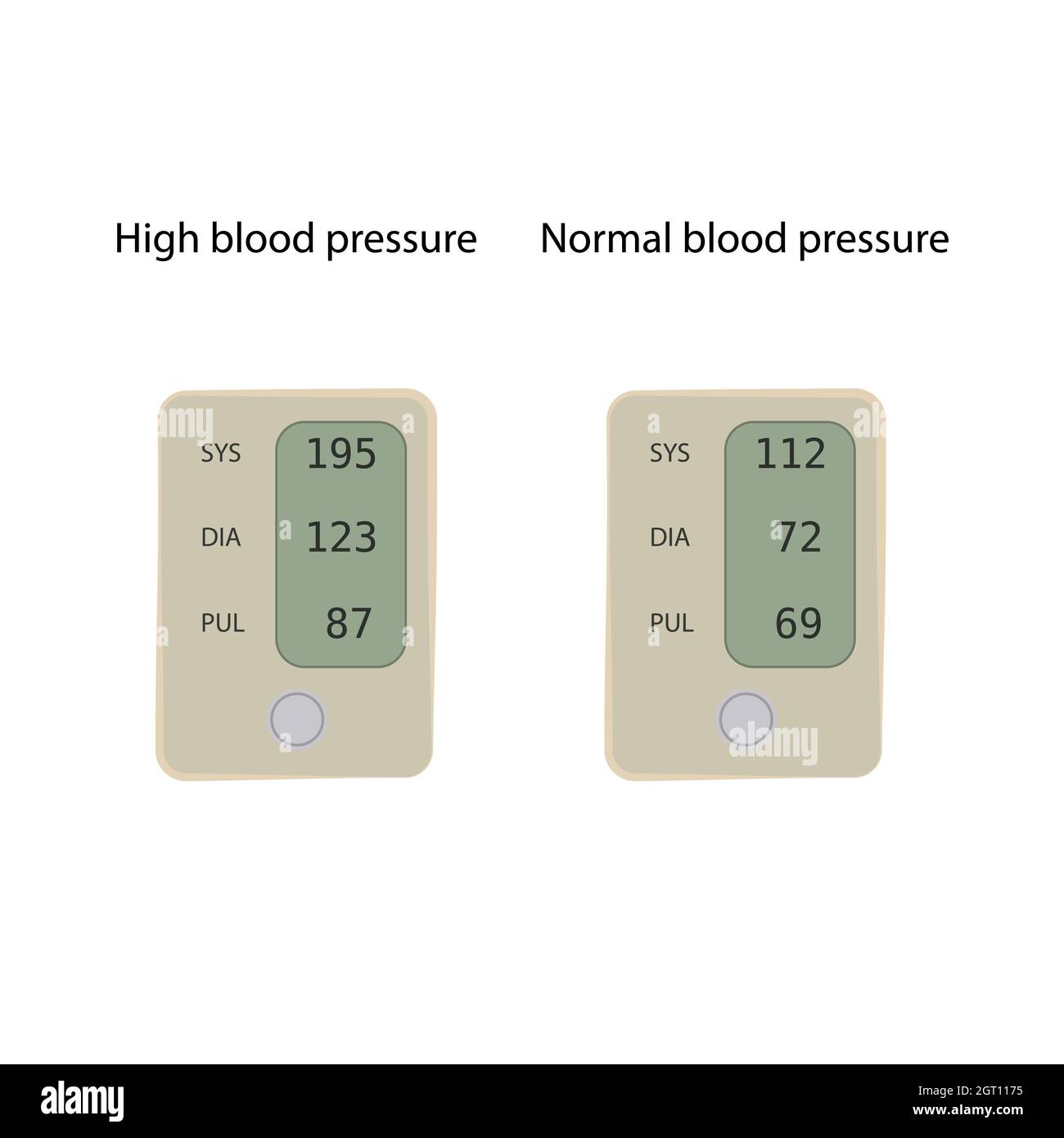 Normal and high blood pressure, illustration Stock Photo - Alamy