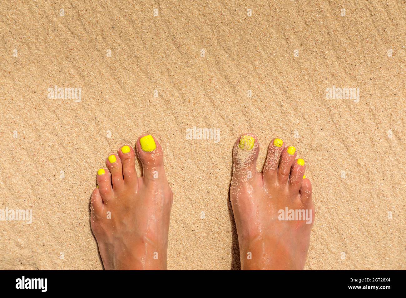 Yellow toenail hi-res stock photography and images - Alamy