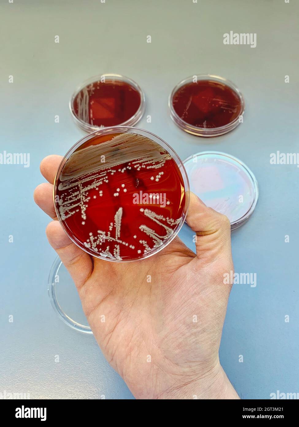 Bacterial agar hi-res stock photography and images - Alamy