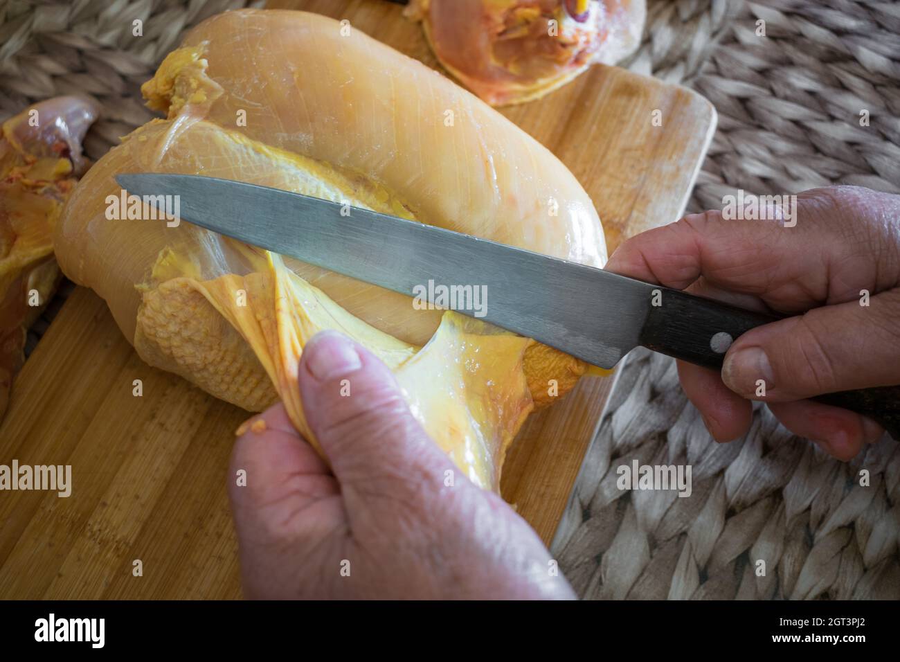 Skinless person hi-res stock photography and images - Alamy