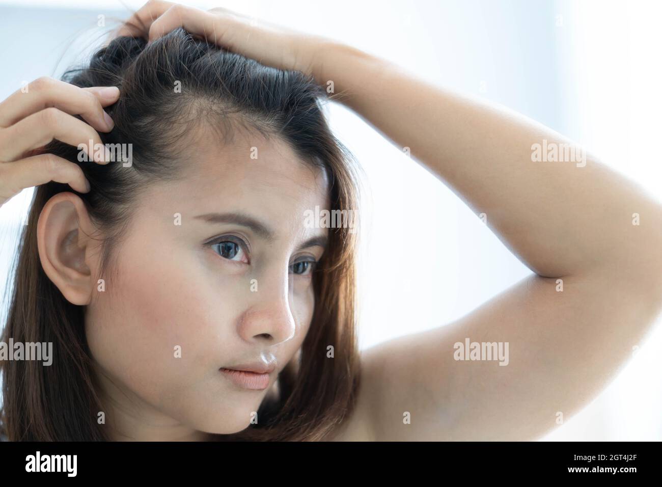 Hair loss indian women hi-res stock photography and images - Alamy