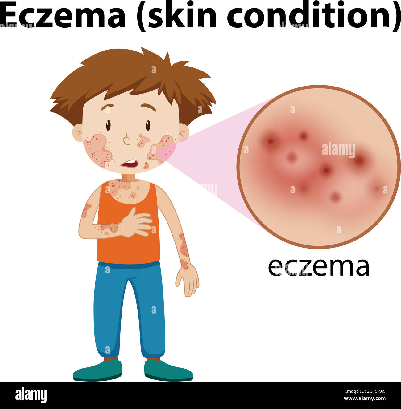 Eczema Drawing