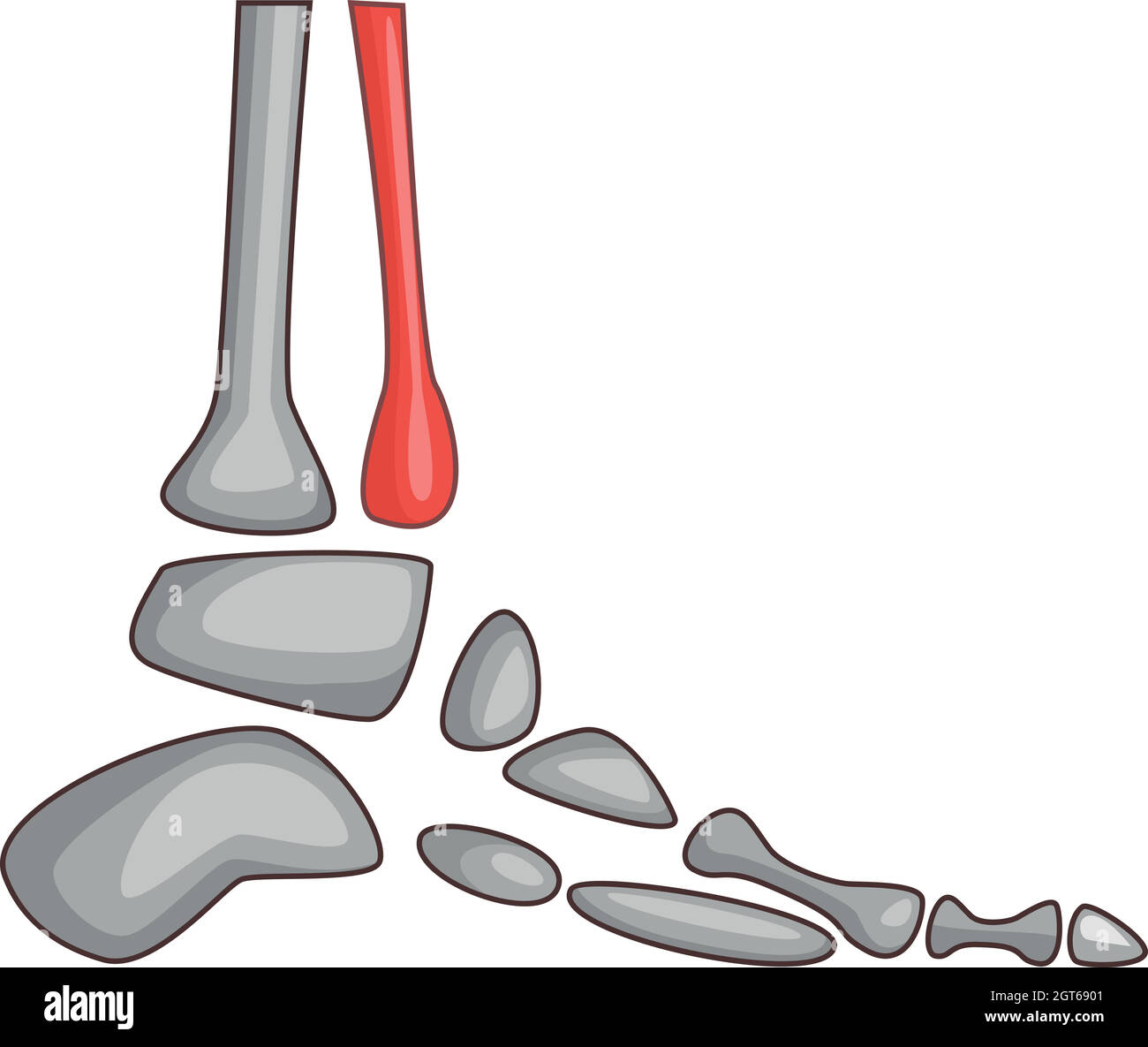 Ankle x ray fracture Stock Vector Images - Alamy