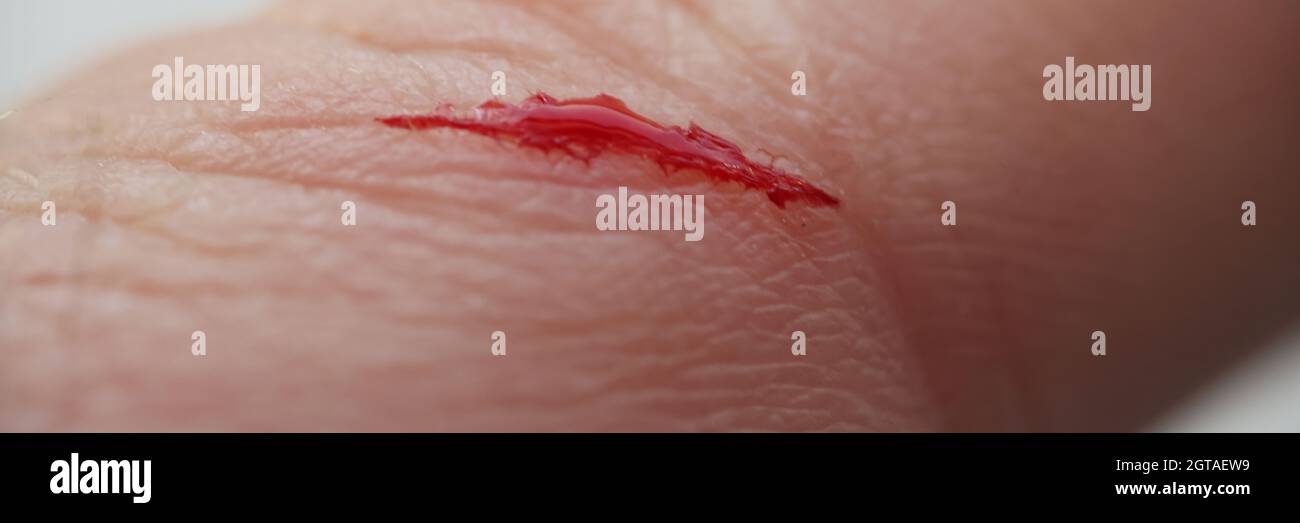 Hand cut blood bleeding hi-res stock photography and images - Alamy