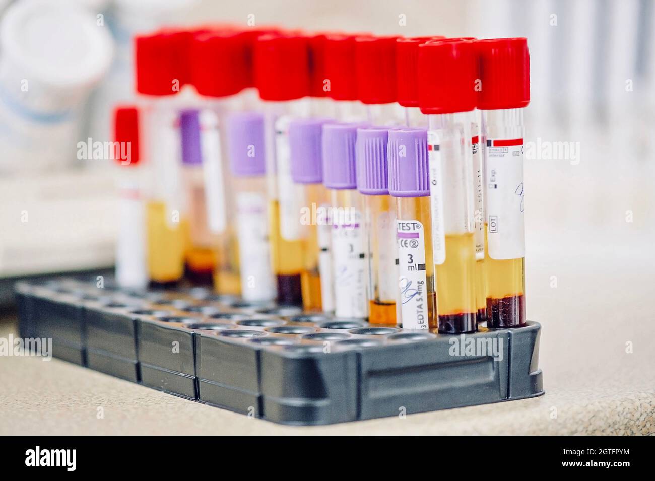 Medical specimen bottles High Resolution Stock Photography and Images ...