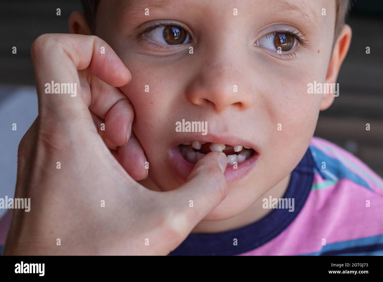 Tooth pushing hi-res stock photography and images - Alamy