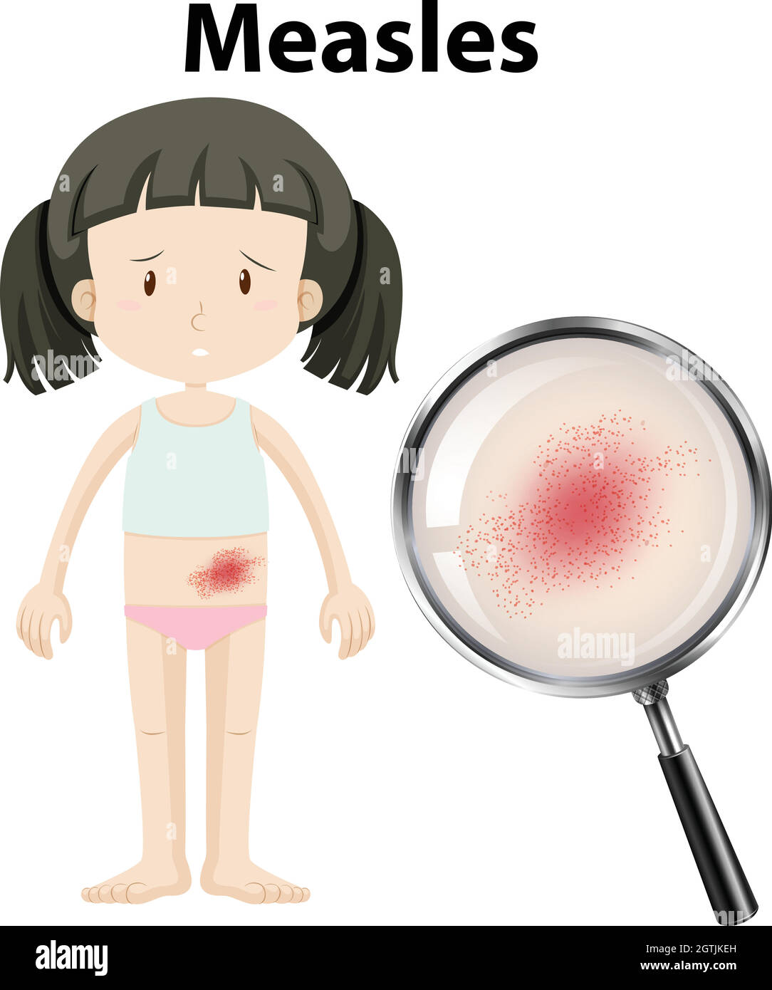 Measles immunity Stock Vector Images - Alamy