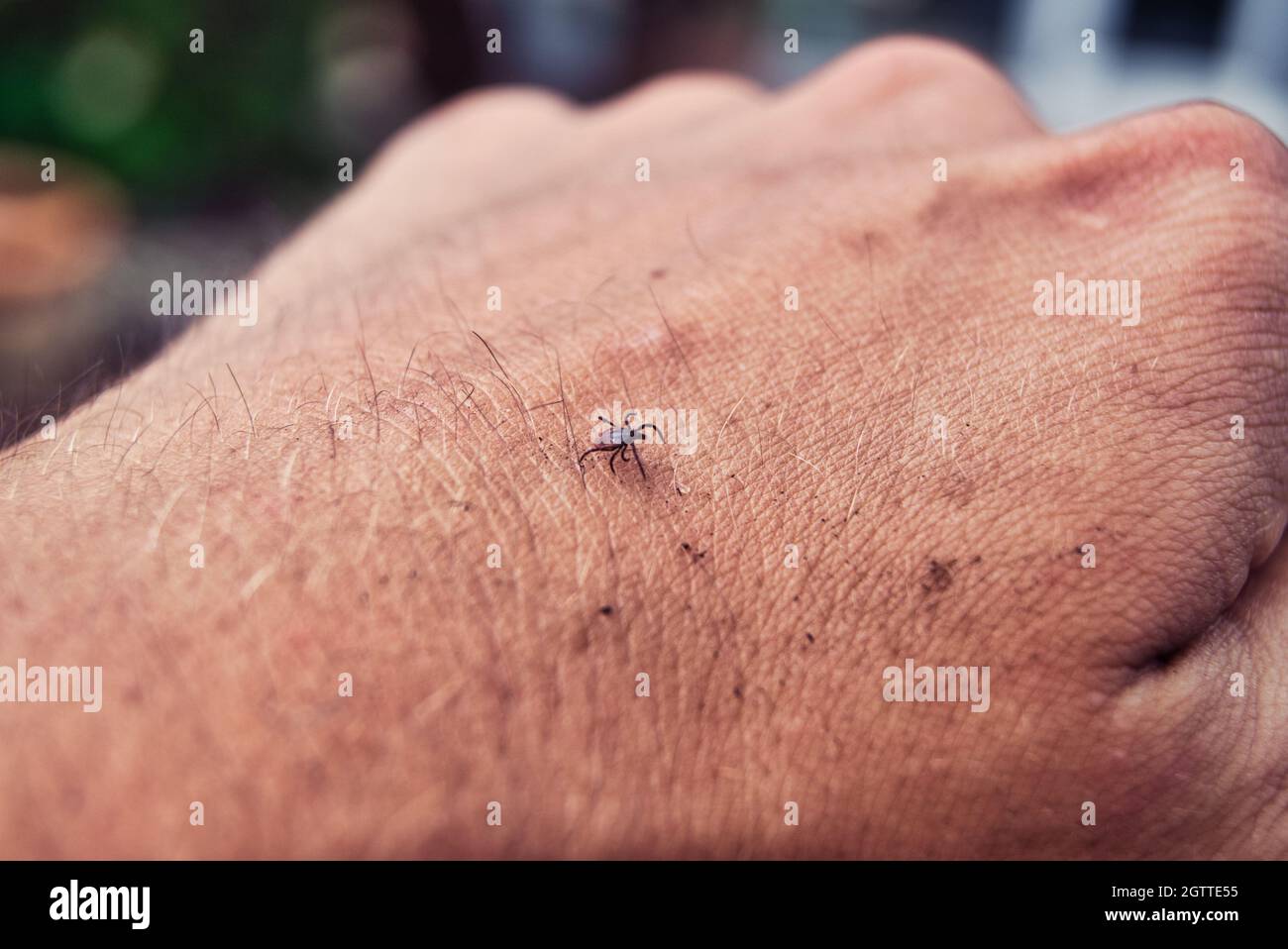Tick on hand hi-res stock photography and images - Alamy