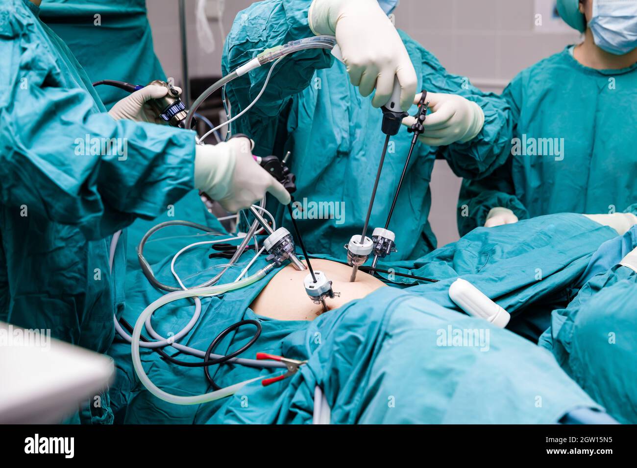 Abdominal operation hi-res stock photography and images - Alamy