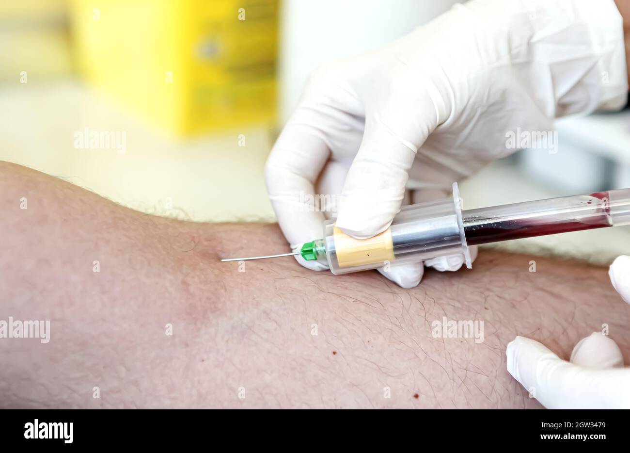 Fingerprick blood test hi-res stock photography and images - Alamy
