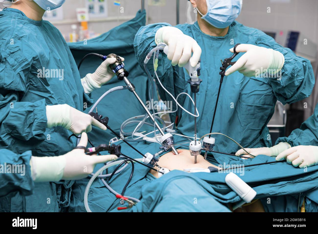 Endoscope cancer hi-res stock photography and images - Alamy