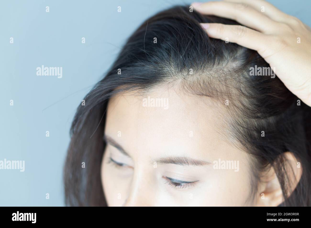 Woman see scalp hi-res stock photography and images - Alamy