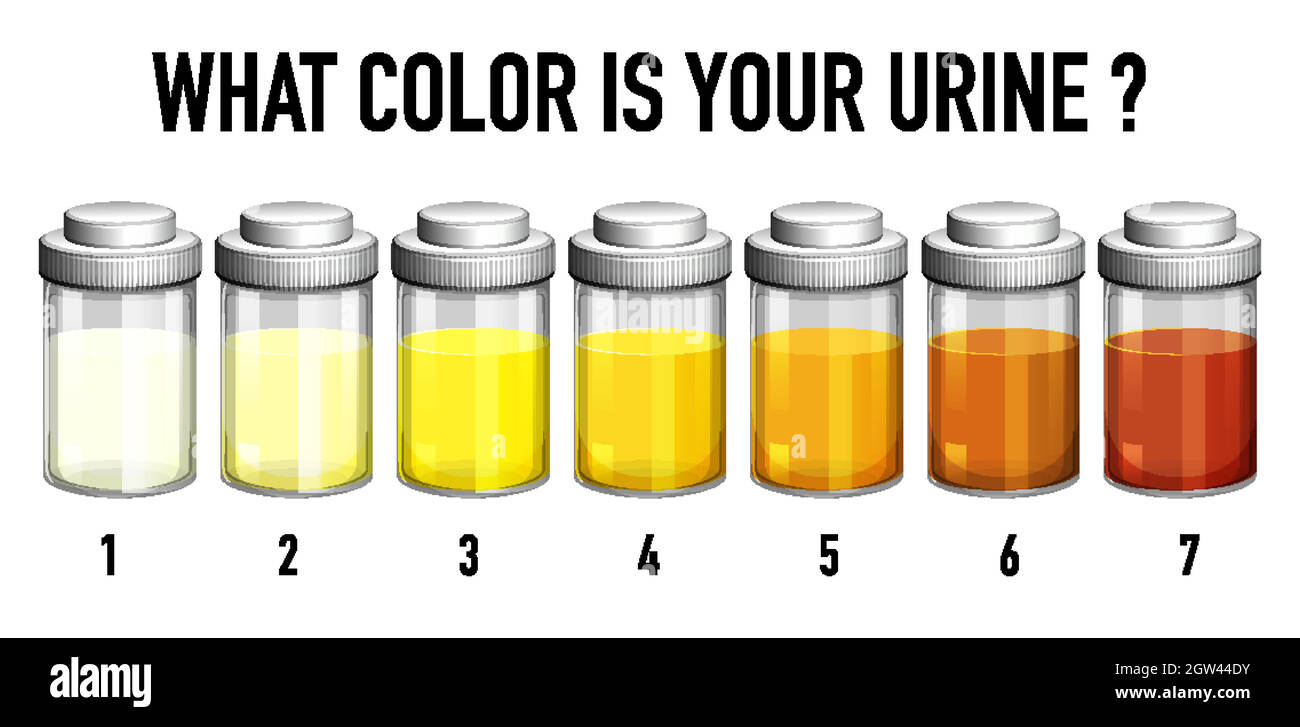 Illustration of urine color chart Stock Vector Image & Art - Alamy
