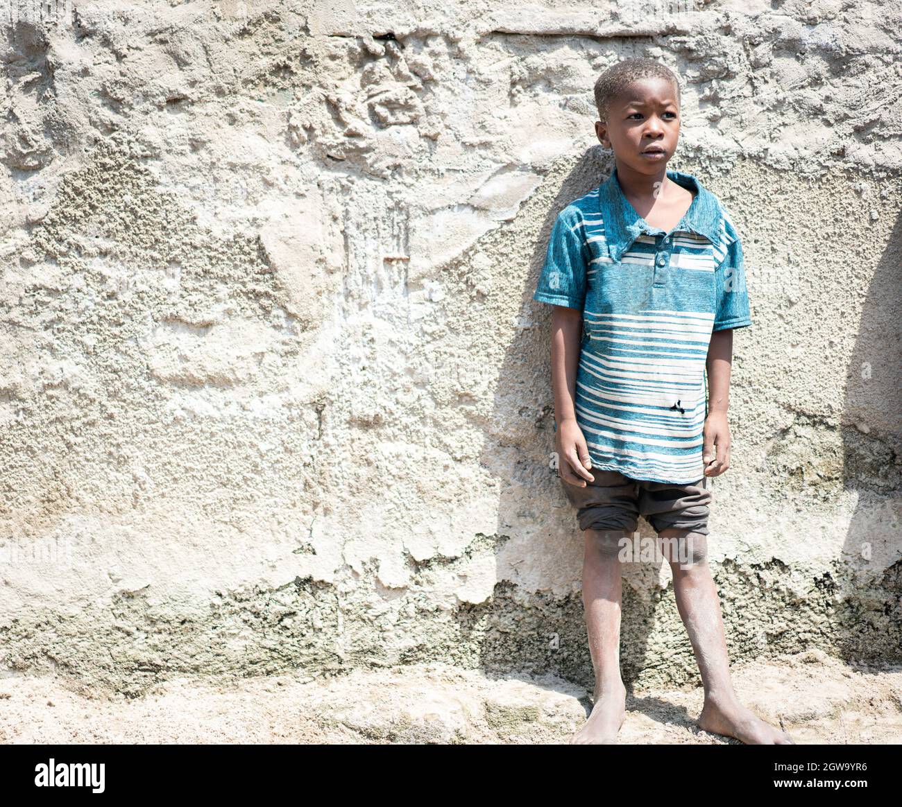 Child africa hungry hi-res stock photography and images - Alamy